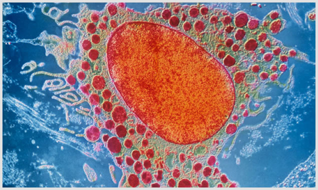 VIDEO: Reducing Transfusion-Transmitted Cytomegalovirus - Transfusion News