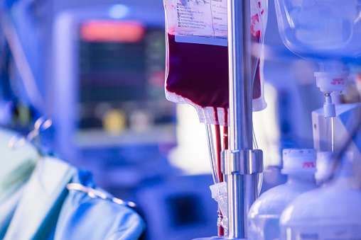 New Criteria for Transfusion-Associated Circulatory Overload (TACO ...