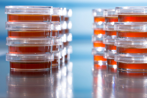 Large-Scale Production of Red Blood Cells from Peripheral Blood ...