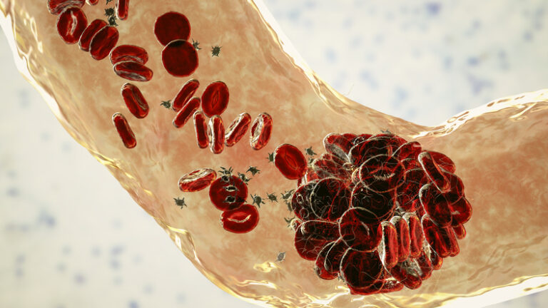 Recombinant ADAMTS13 Treatment for Congenital Thrombotic ...