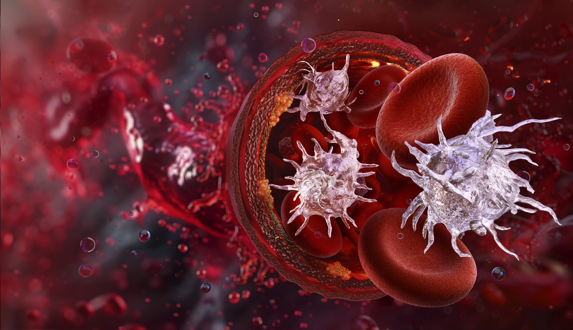 New Guidelines for Platelet Transfusion Recommend Restrictive ...